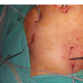 Location Of The Port Download Scientific Diagram