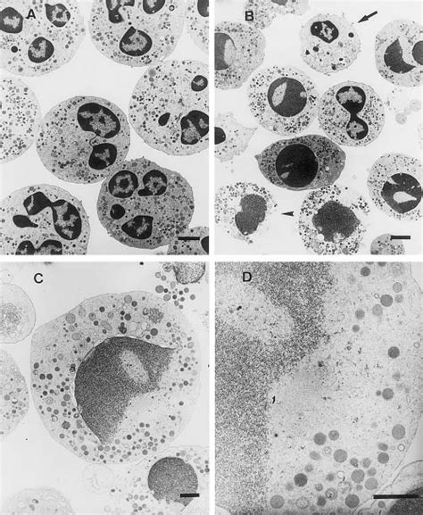 Electron Microscopy Of Neutrophils Neutrophils Were Incubated With Or Download Scientific