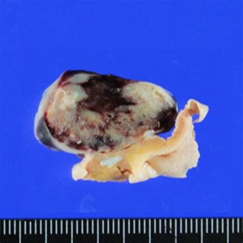 The Surface Was A Mixture Of Smooth And Non Smooth Areas The Split