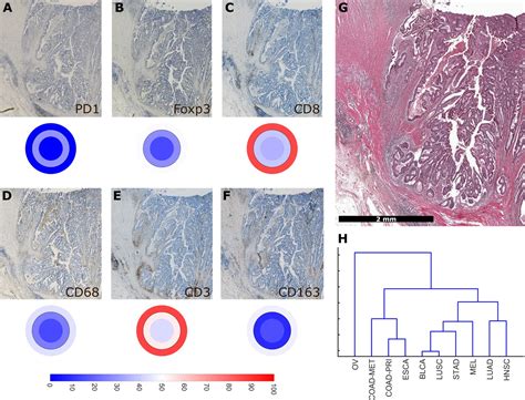 Topography Of Cancer Associated Immune Cells In Human Solid Tumors ELife