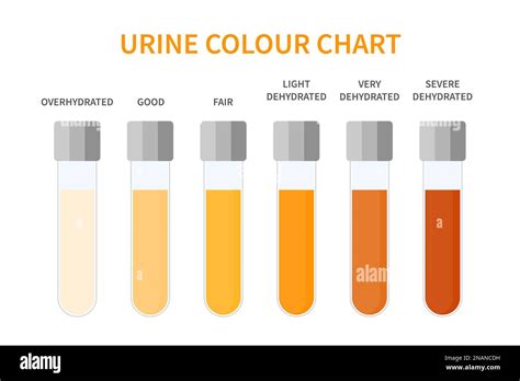 Urine Color Chart For Dehydration Ponasa
