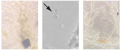培养细胞污染真菌的原因 知乎