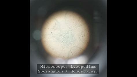 Microscope Sporangium Of Lycopodium Youtube