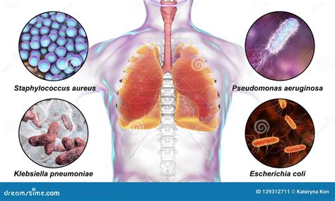 Human Respiratory Pathogens Stock Illustration Illustration Of Antibiotic Aureus 129312711