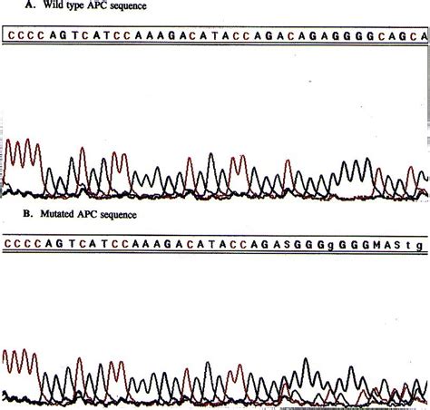 Sequence Analysis Of The Mutated Region In Exon A Normal Download Scientific Diagram