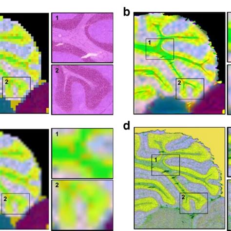 Super Resolution Spatial Transcriptomics Reconstruction Of A Mouse Download Scientific Diagram