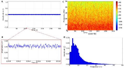 Basal Electrocorticographic Tracing N 9 A Ecog Signal Obtained Download Scientific