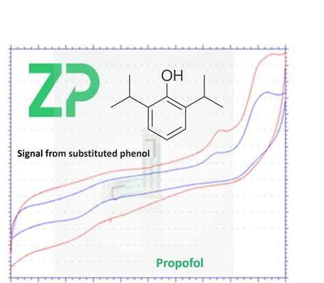 Sensors For Propofol Zimmer And Peacock As