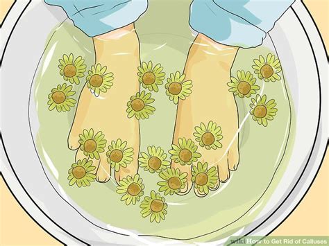 3 Ways To Get Rid Of Calluses Artofit