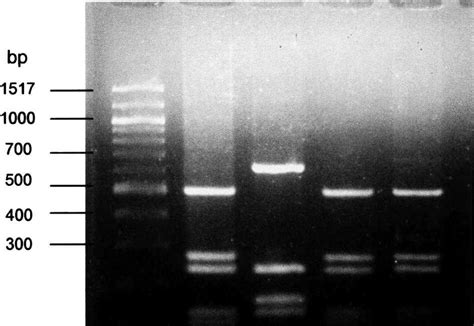 Restriction Fragment Length Polymorphism Analysis Of R Anatipestifer Download Scientific