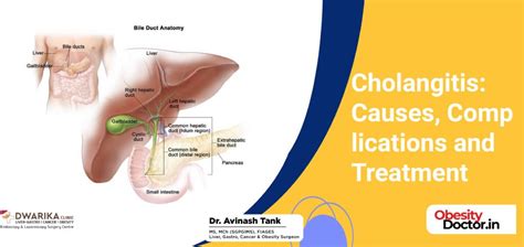 Cholangitis Causes Complications And Treatment Dr Avinashtank Is A