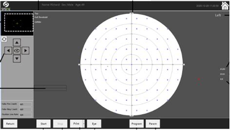 Perimeter Ophthalmic Perimetry Test Instrument 200ms Impact Body