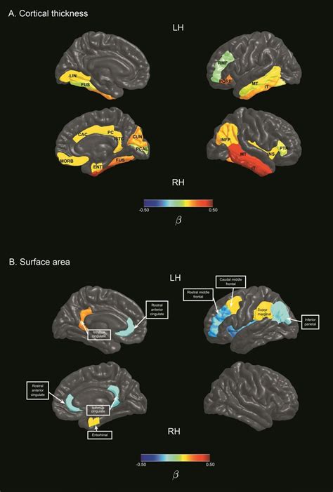 cortical features selected using regularised regression models colour