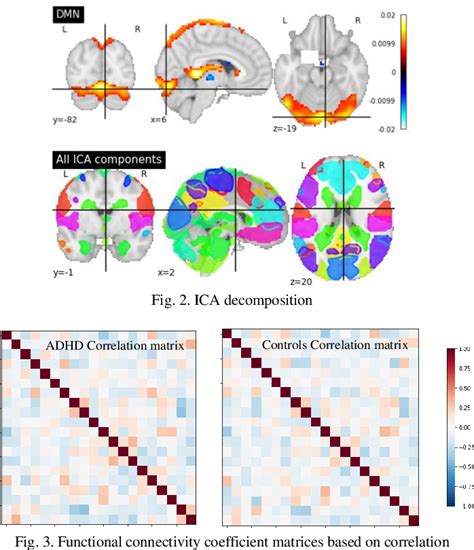 Figure 2 From Classification Of Attention Deficit Hyperactivity Disorder Using Variational