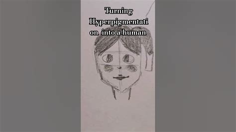 Hyperpigmentation Wo Art Drawing Youtube
