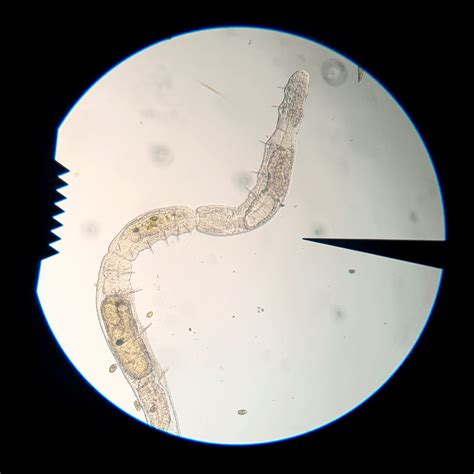 Help Id This Worm In Freshwater Pond Sample Chicago R Microscopy