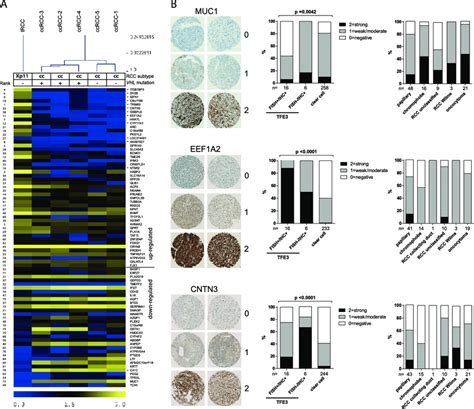 Gene Expression Profile From RNA Seq Data Supports A Known Renal Download Scientific Diagram