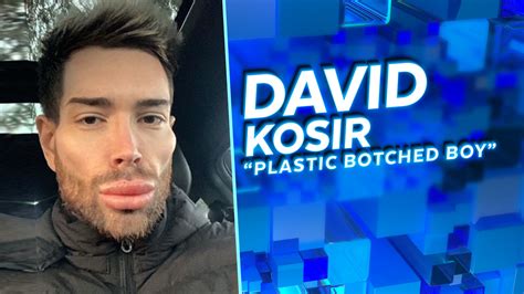 The More Plastic The More Fantastic David Kosir Spent 100000 To Look Like A Ken Doll
