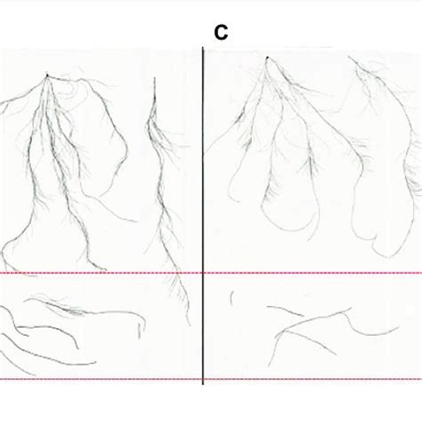 Different Types Of Roots A Accessions With Small Seminal Root B Download Scientific