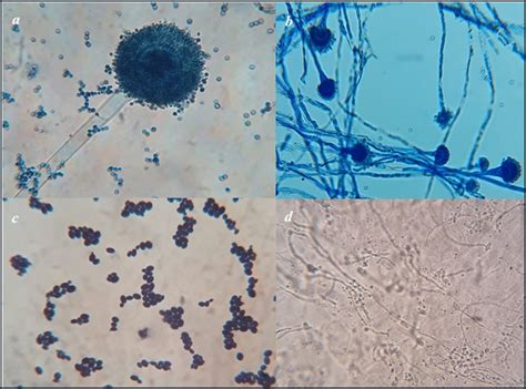 A And B Lpcb Mount Shows Aspergillus Spp Under Microscopic Examination Download Scientific