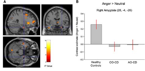 Figure From Psychopathic Traits Influence Amygdalaanterior Cingulate Cortex Connectivity