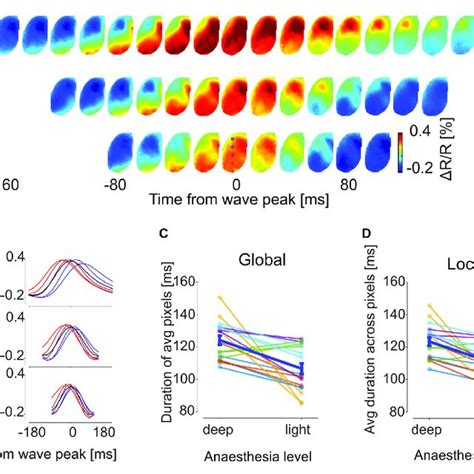 Wave Propagation Speed At Different Anesthetized States Propagation