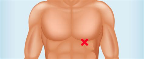 How To Assess Pulse Points As An Rn