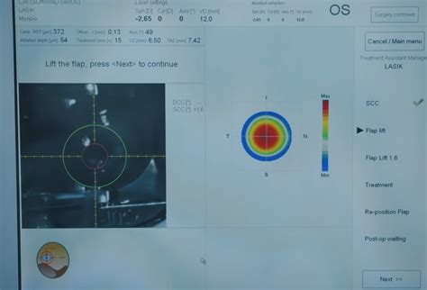 Лечение глаукомы в Москве Доктор Шкуренко Игорь Валерьевич Офтальмолог хирург