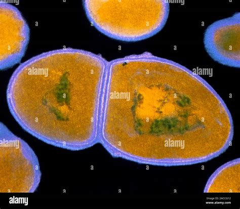 Enterococcus Faecalis Coloured Transmission Electron Micrograph Tem Of Enterococcus Faecalis