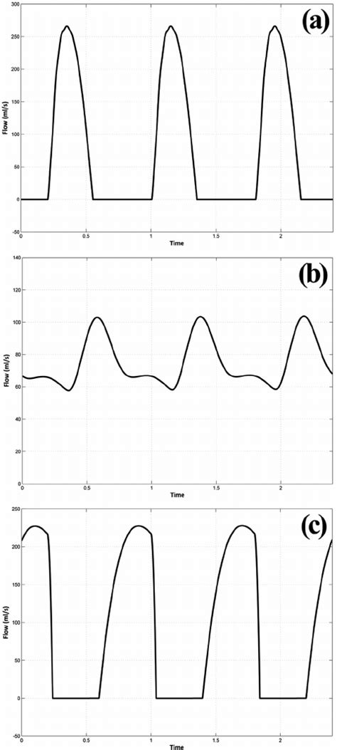 Flow Time Graph Of Pulmonary Circulation Under Normal Condition A