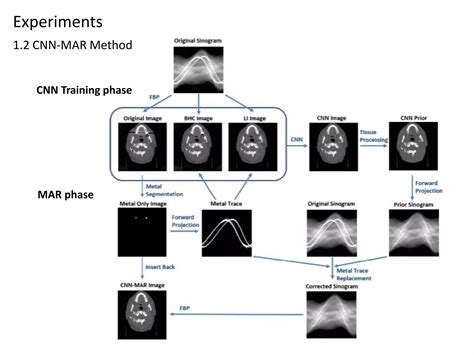 Convolutional Neural Network Based Metal Artifact Reduction In X Ray Computed Tomography Ppt