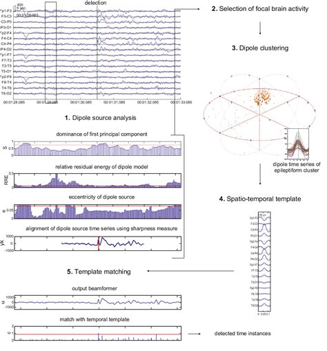 Figure 1 From Detection Of Focal Epileptiform Events In The Eeg By Spatio Temporal Dipole