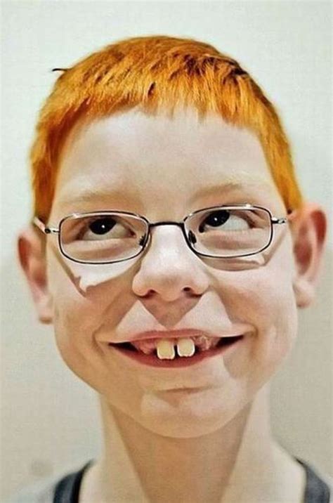 35 Most Funniest Weird Face Pictures That Will Make You Laugh