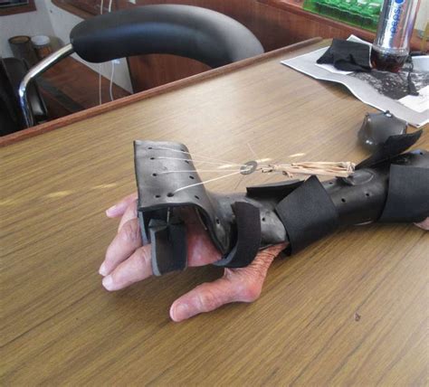 Yesterdays Dream February 19 Outrigger Splint In Action