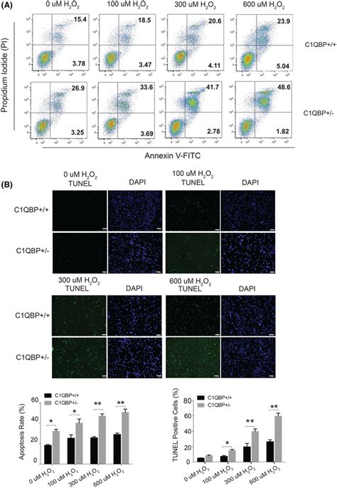 complement c1q binding protein c1qbp knockdown aggravates t cells