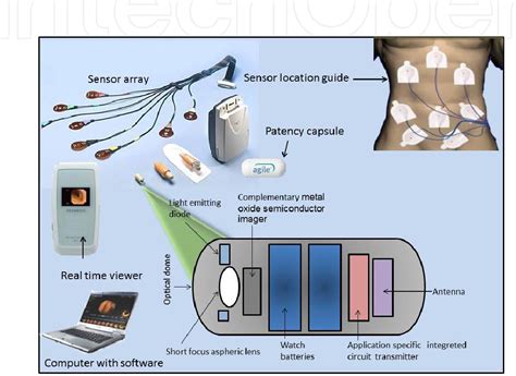 Capsule Endoscopy Belt