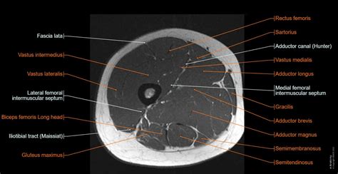Lower Limb Mri Anatomical Atlas E Anatomy
