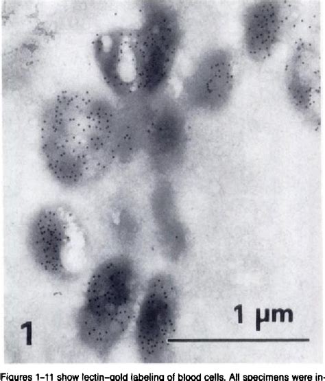 Figure 1 11 From Lectins For Electron Microscopic Distinction Of