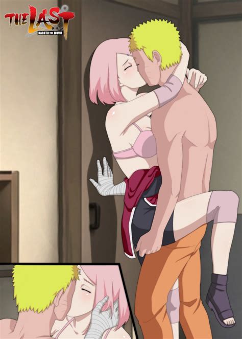 Rule 34 1boy 1girls Against Wall Arm Support Bandaged Arm Bandages Before Sex Blush Bra Close