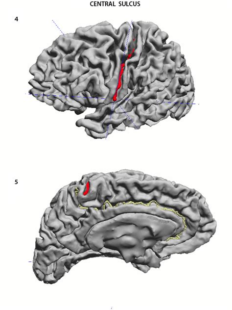 Intraparietal Sulcus Location