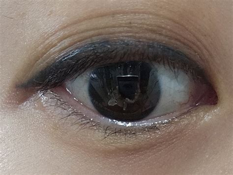 15년 된 아이라인 문신 제거 2차 내돈내산 반영구 아이라인 제거 네이버 블로그