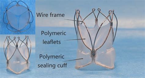 Punit G Posted On Linkedin