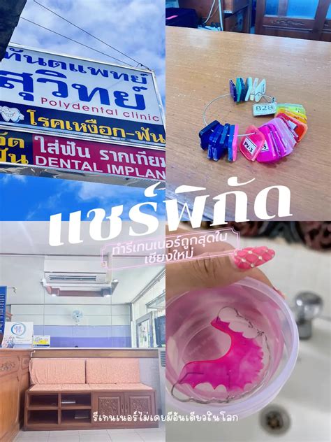 แปะพิกัด เชียงใหม่ทำรีเทนเนอร์ที่ไหนดี แกลเลอรีที่โพสต์โดย กอนอพาไปเที่ยว Lemon8