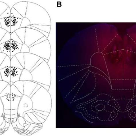 Schematic Representation Of The Majority Of Injection Cannula Tip Download Scientific Diagram