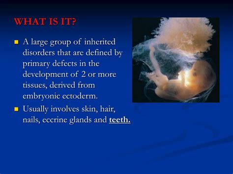 Ppt Ectodermal Dysplasia Dental Calamity In Your Mouth Powerpoint Presentation Id 4426526