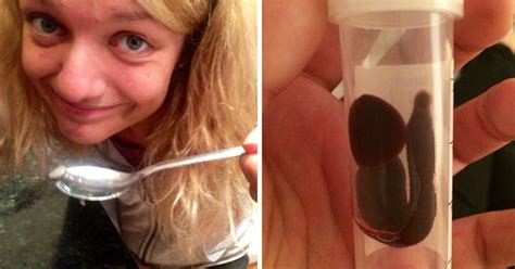 Backpacker Daniela Liverani Had Three Inch Leech Living In Her Nostril