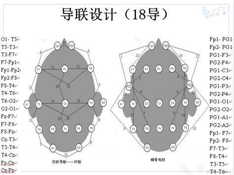癫痫脑电信号解析 csdn博客