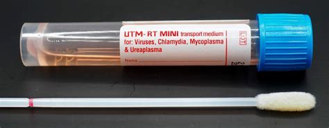 Quest Diagnostics Syphilis Swab At Troy Jenkins Blog