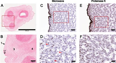 Figure 2 From Histological Characterization Of Class I Hla Molecules In