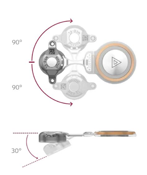 The MED EL Spotlight On BONEBRIDGE Surgical Insights On Optimizing Clinical Practice Outcomes